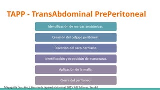 HERNIA INGUINAL CIRUGIA POR LAPAROSCOPIA | PPTX
