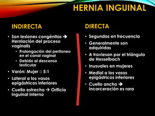 Hernia Directa Vs Indirecta