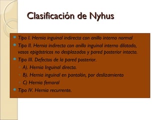 Hernia inguinal R2 | PPT