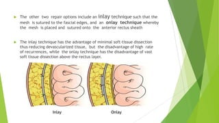 Hernial prosthesis | PPTX