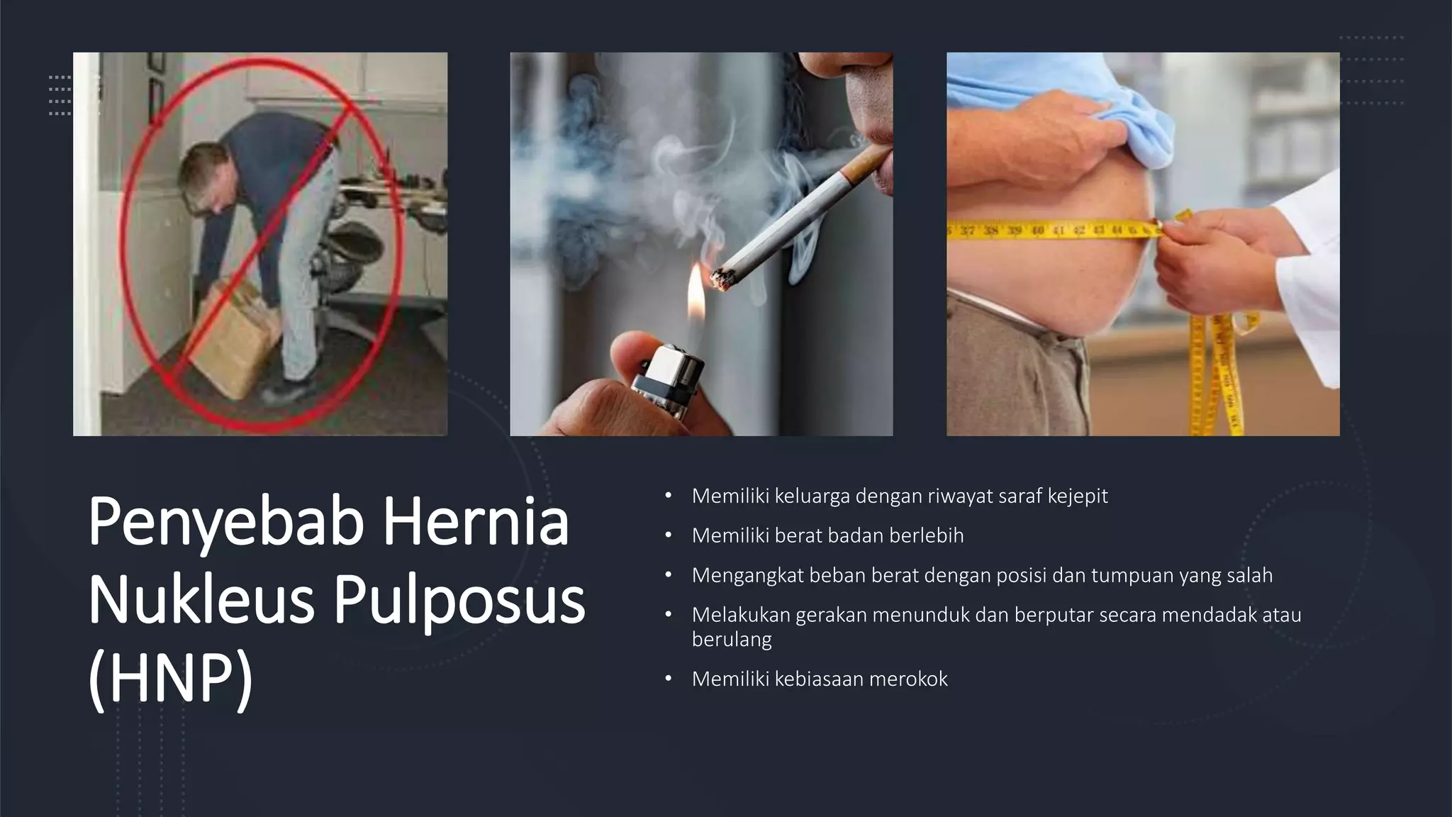 Hernia Nucleus Pulposus ( HNP ).pptx