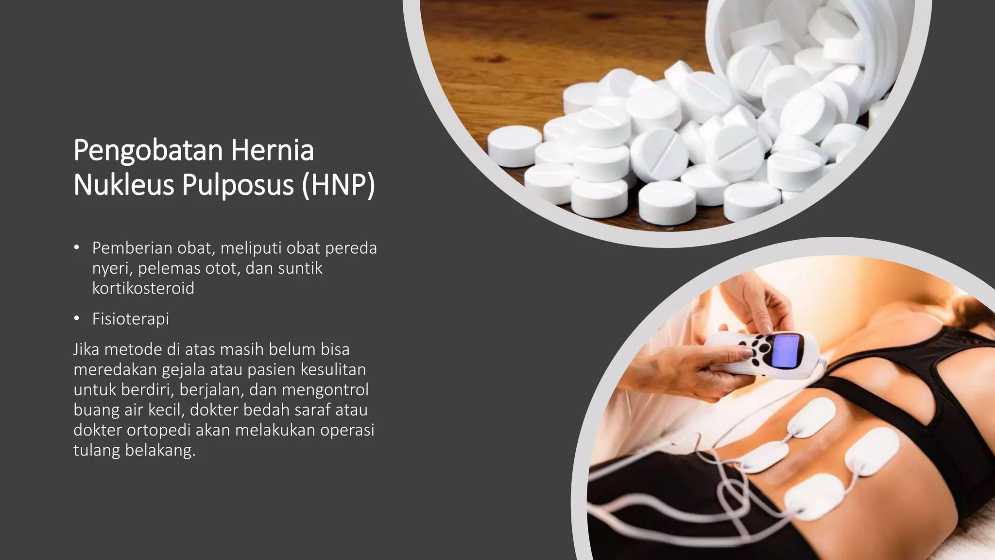 Hernia Nucleus Pulposus ( HNP ).pptx