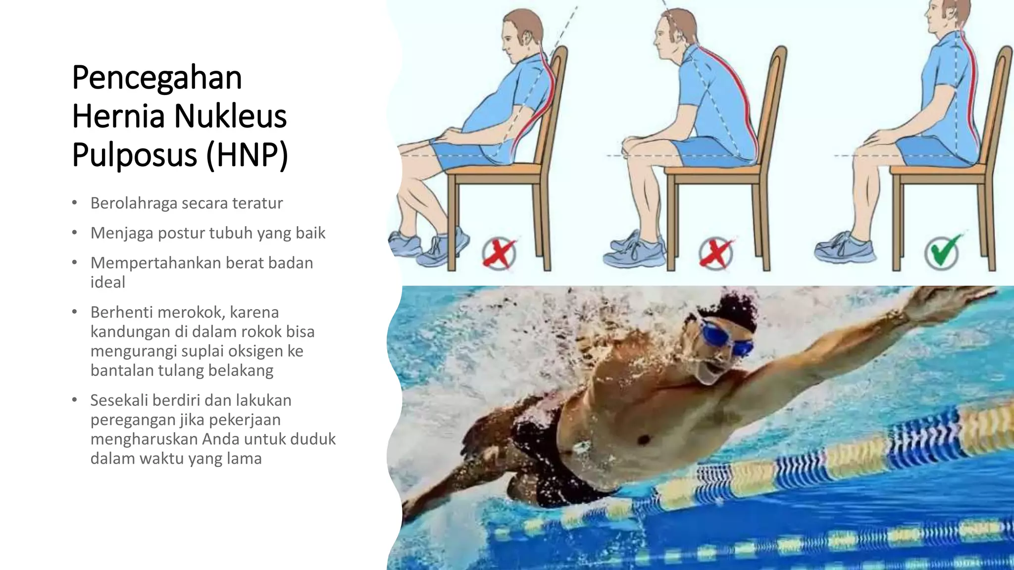 Hernia Nucleus Pulposus ( HNP ).pptx