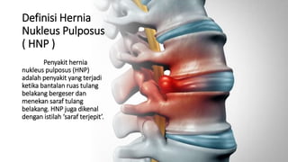 Hernia Nucleus Pulposus ( HNP ).pptx