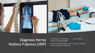 Hernia Nucleus Pulposus ( HNP ).pptx