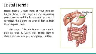 Hernia Clinics | PPT