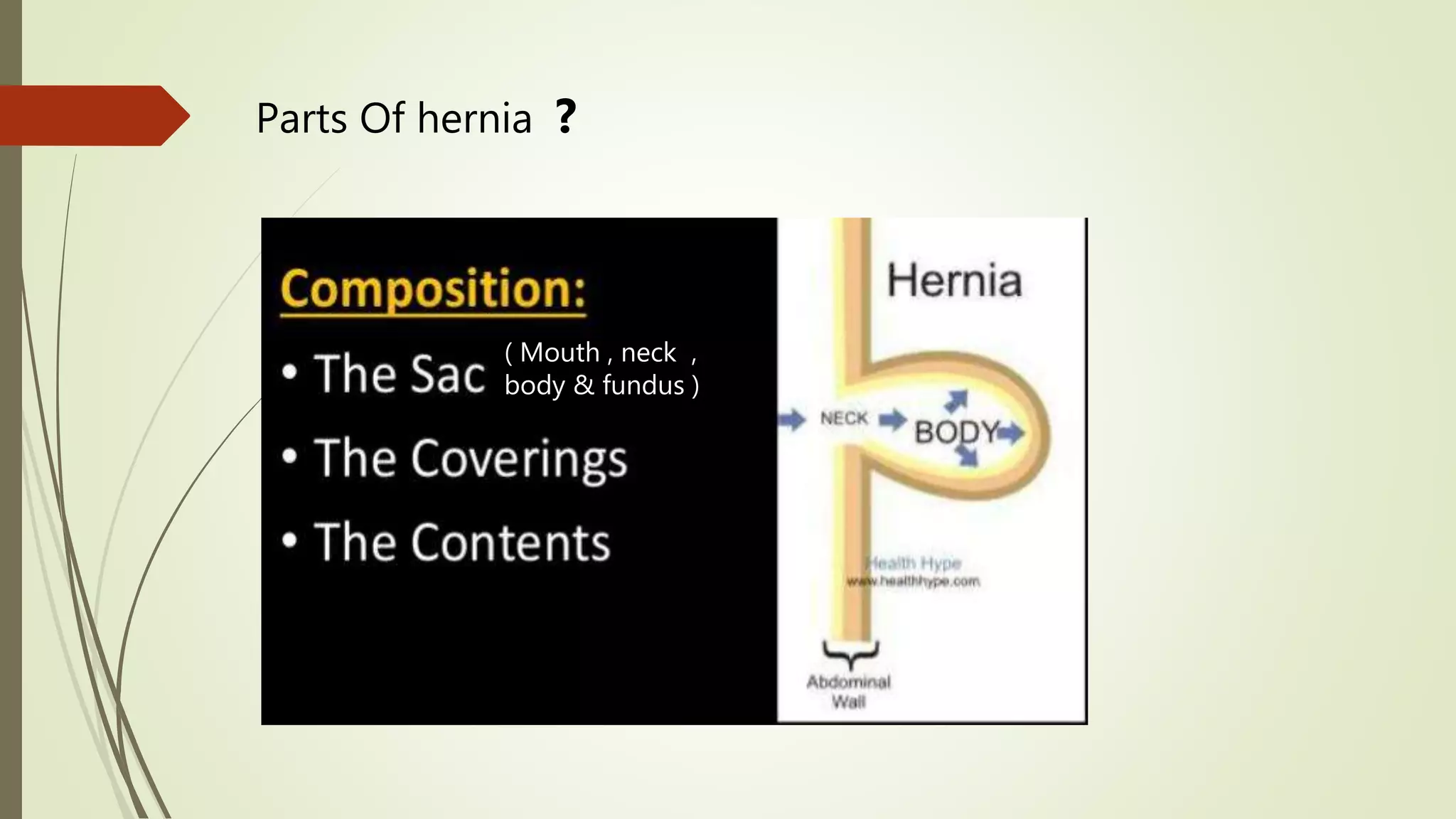 HERNIA PDF.pdf