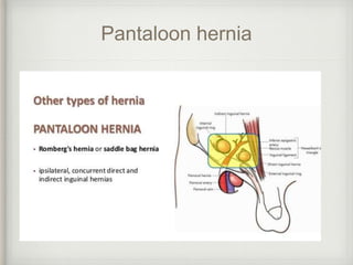 Hernia | PPTX