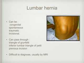 Hernia | PPTX
