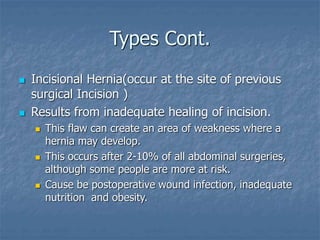 Hernia Presen.pptx