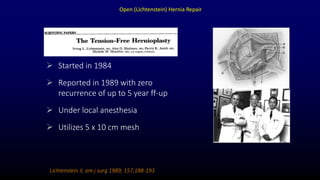 Hernia Repair (Lichtenstein) Kuliah.pptx