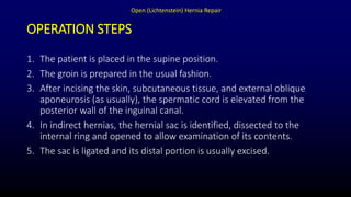 Hernia Repair (Lichtenstein) Kuliah.pptx