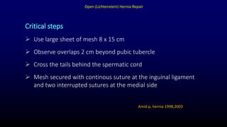 Hernia Repair (Lichtenstein) Kuliah.pptx