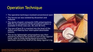 Hernia Repair (Lichtenstein) Kuliah.pptx
