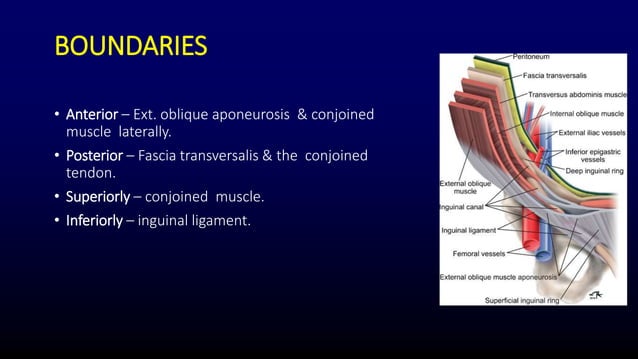 Hernia Repair (Lichtenstein) Kuliah.pptx