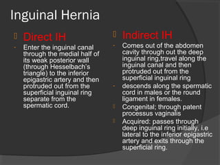 Hernia by Dr. Rubzzz | PPT
