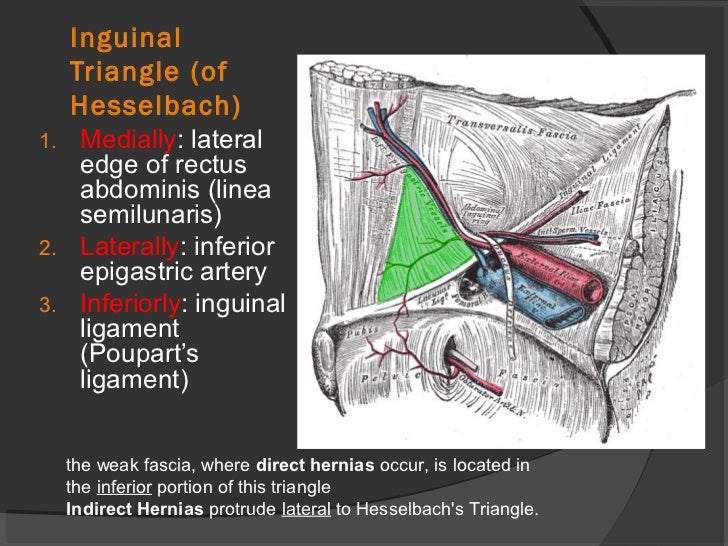 Hernia by Dr. Rubzzz