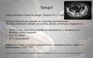 Hernias | PPTX