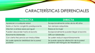 Hernia Directa Vs Indirecta