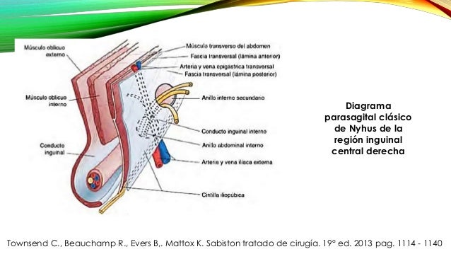 Hernias (Inguinales directas e indirectas, femorales o crurales y epi…
