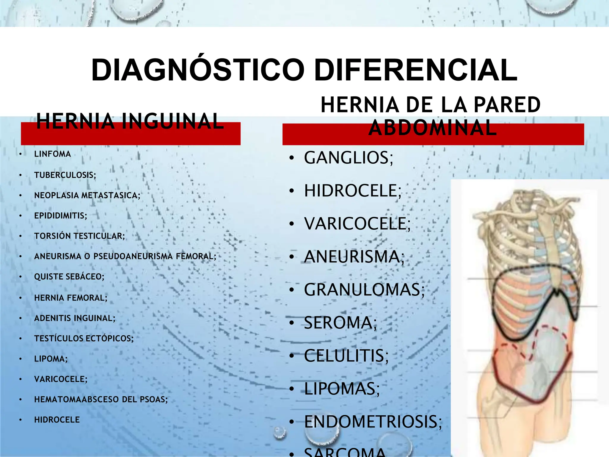 Tipos de hernias quirúrgicas y sus tratamientos | PPT