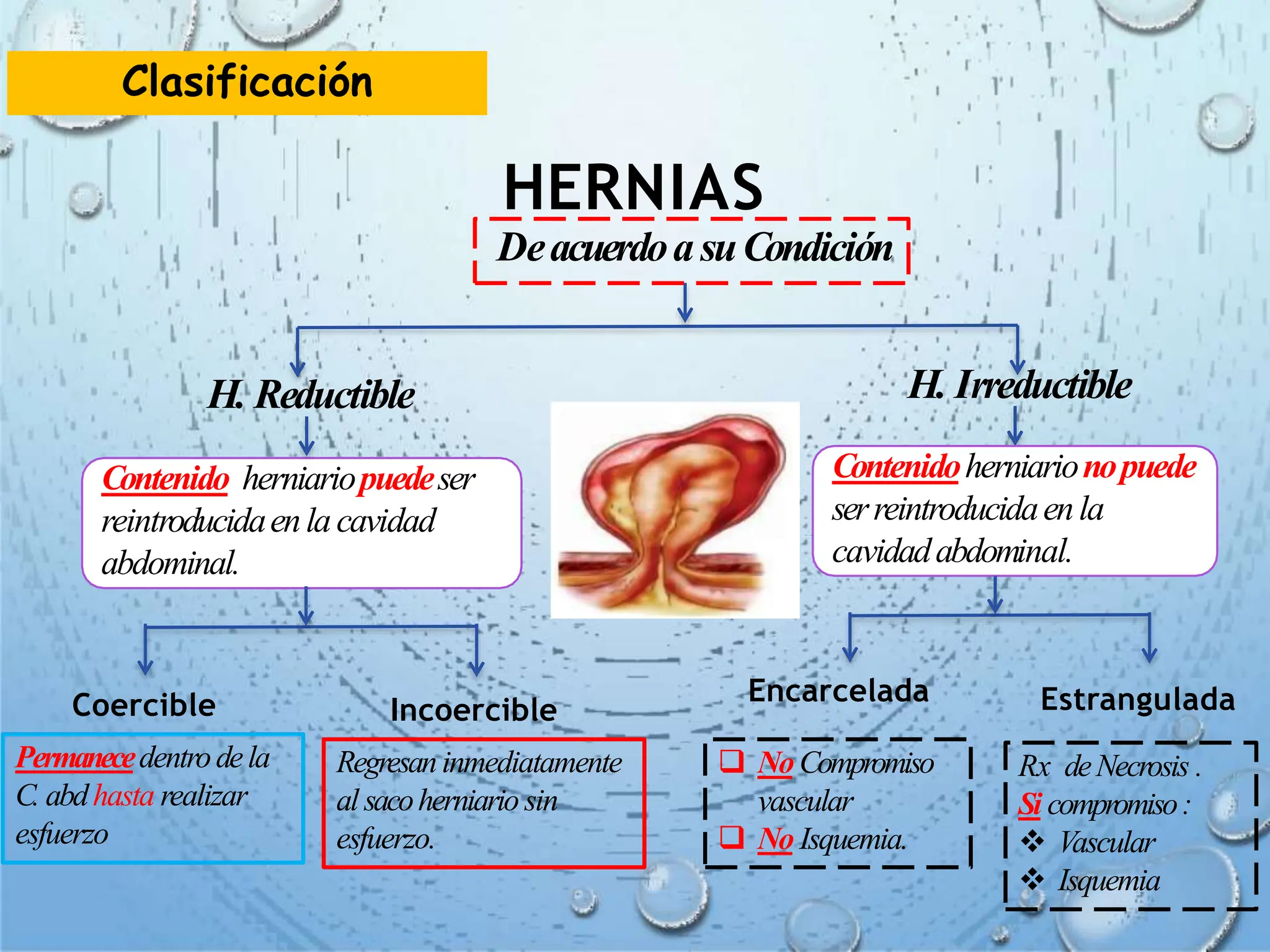 Tipos de hernias quirúrgicas y sus tratamientos | PPT