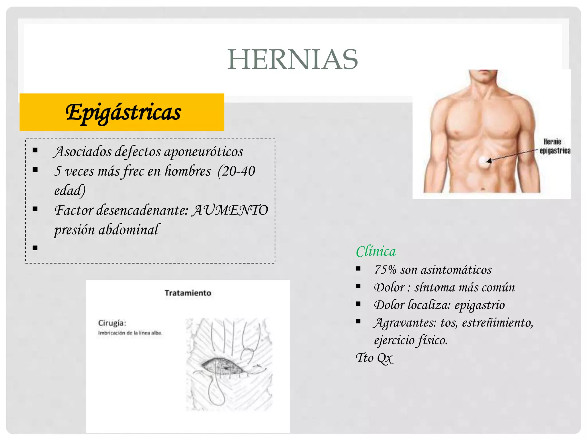 Hernias abdominales, hernia femoral hernia inguinal | PPTX