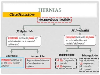 Hernias abdominales, hernia femoral hernia inguinal | PPTX