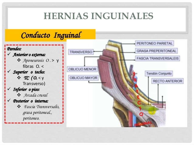 Inguinal And Femoral Hernia