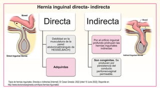 hernias.pptx