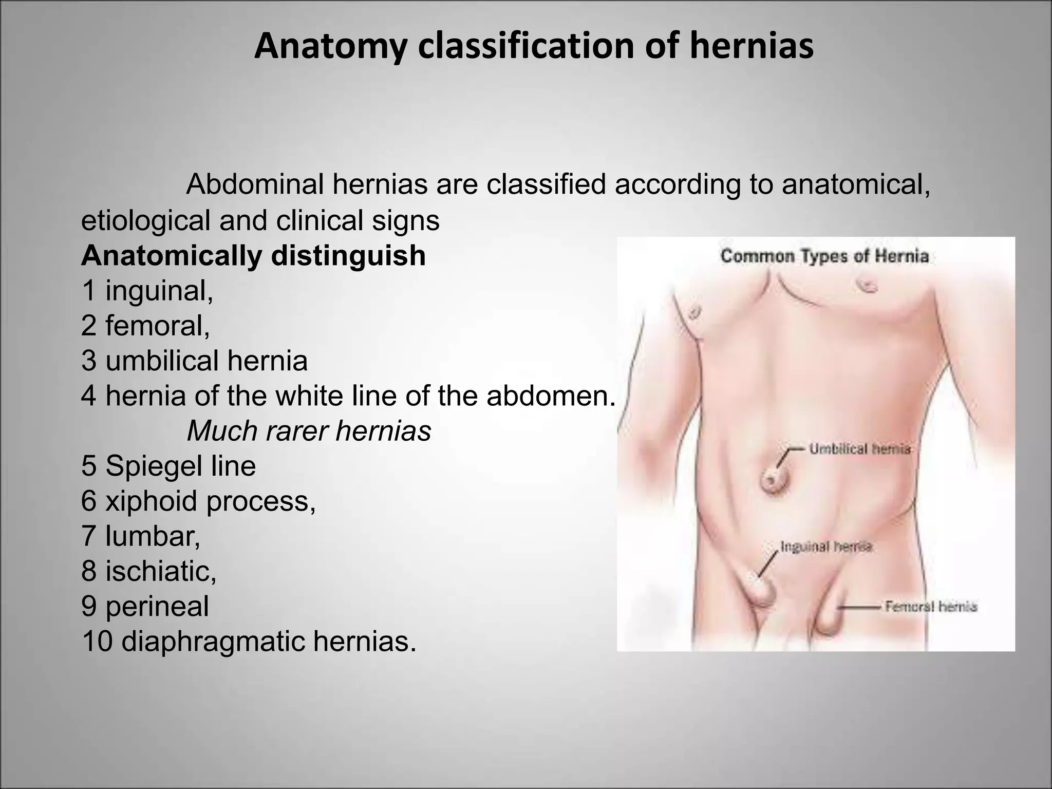 Hernias.ppt