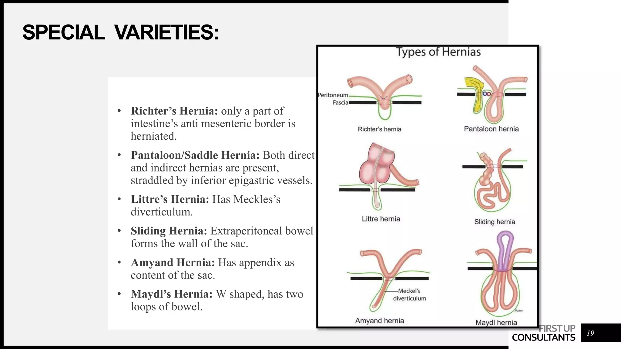 Hernias definition, types, surgical anatomy of inguinal hernia | PPTX