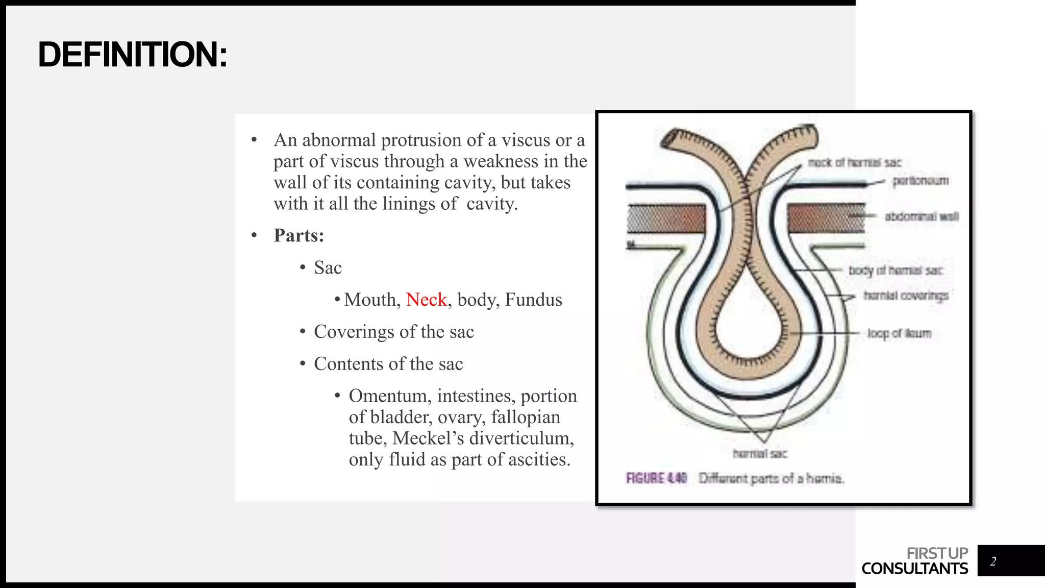 Hernias definition, types, surgical anatomy of inguinal hernia | PPTX