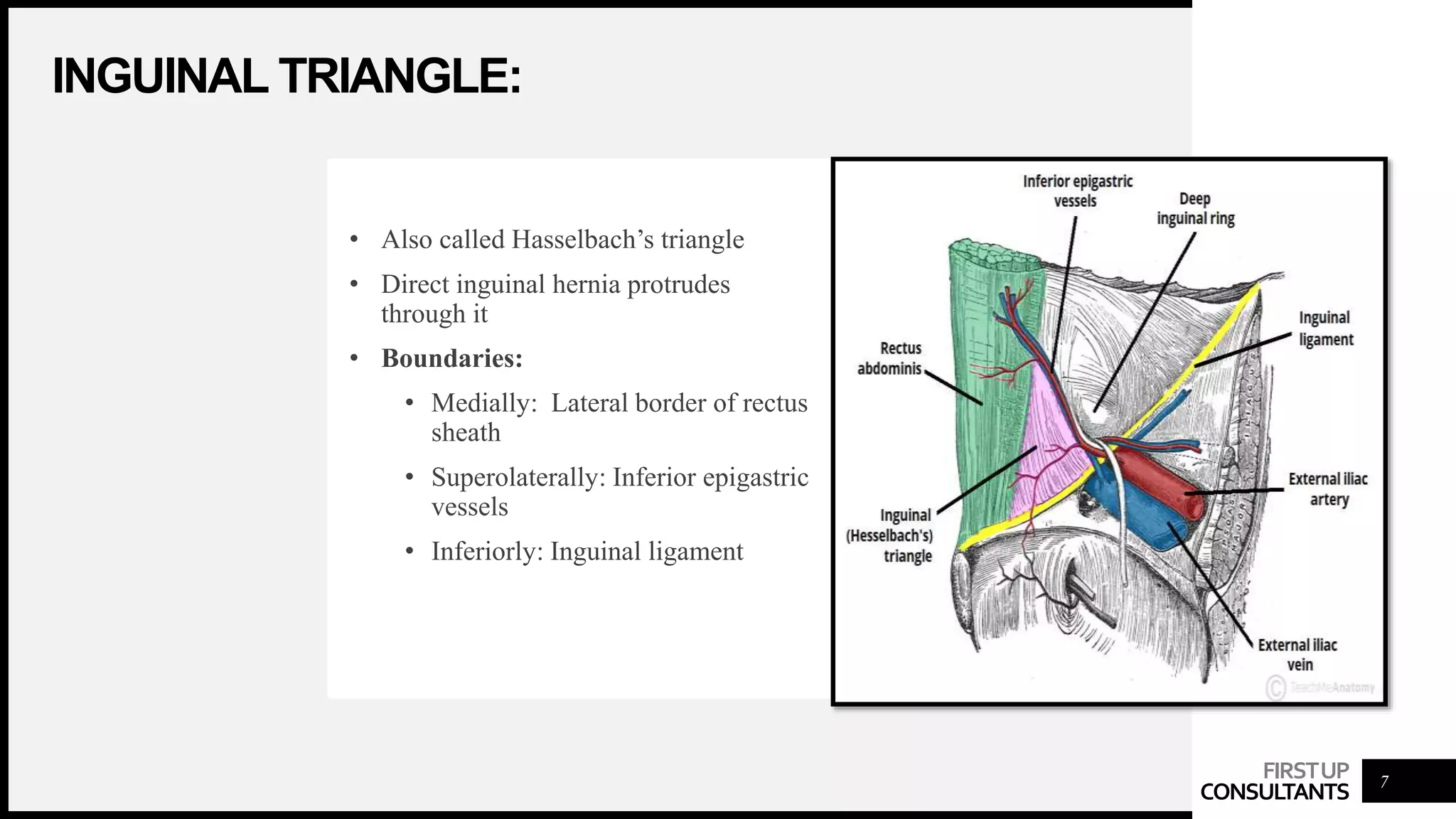 Hernias definition, types, surgical anatomy of inguinal hernia | PPTX