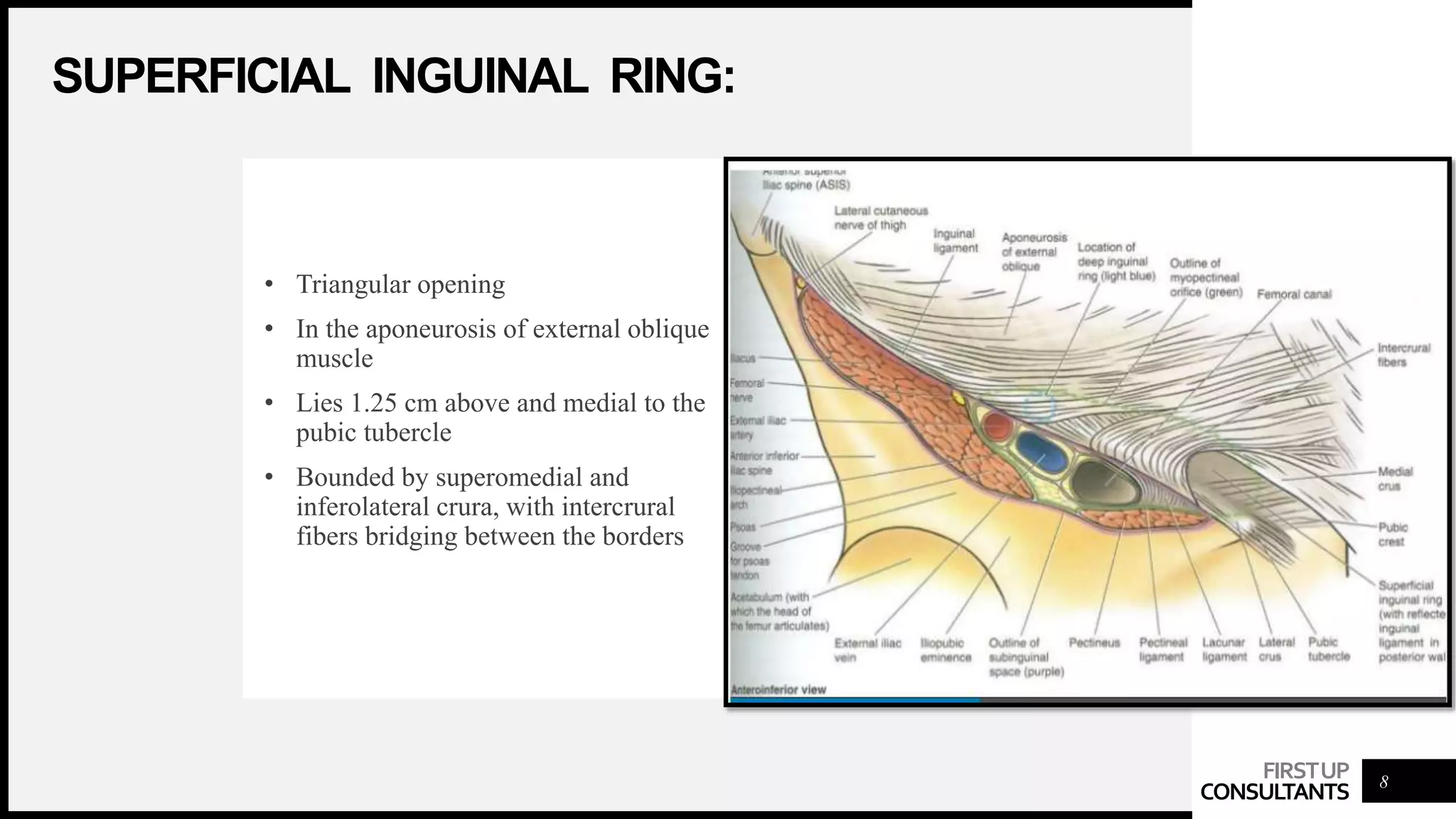 Hernias definition, types, surgical anatomy of inguinal hernia | PPTX