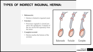 Hernias definition, types, surgical anatomy of inguinal hernia | PPTX