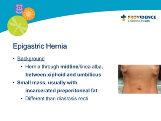 PEDIATRRIC HERNIA WHAT DO AND WHEE -Dr-Gause.pptx