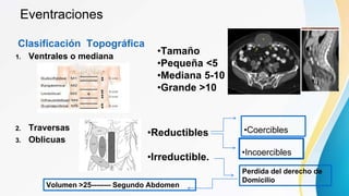 Hernias-eventración-evisceración y traumatismo abdominal)..pptx