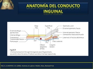Hernias Inguinales FINAL.pptx