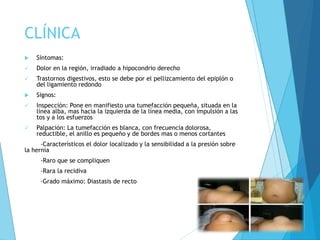 Hernias inguinal, crural, epigastrica | PPT