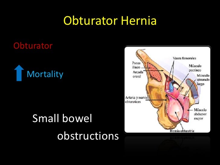Howship Romberg Sign Rehabilitating Romberg | ACNR