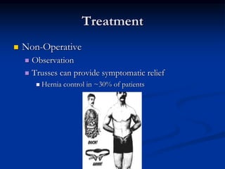 Hernias 2.ppt