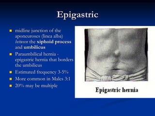 Hernias 2.ppt