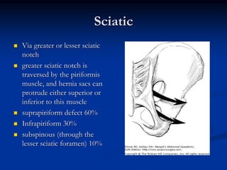 Sciatic Foramen Hernia