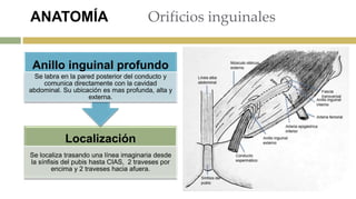 HERNIAS INGUINALES, ANATOMIA ANTONIETA.pptx