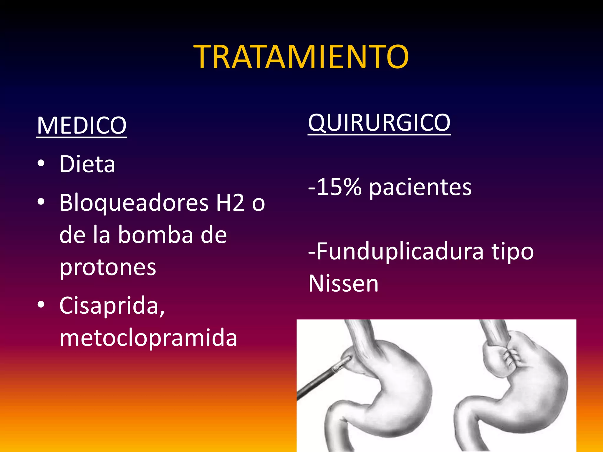 Hernias del hiato esofágico y diafragma | PPTX