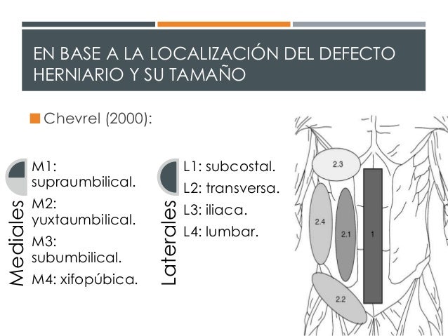 Hernias de pared abdominal anterior