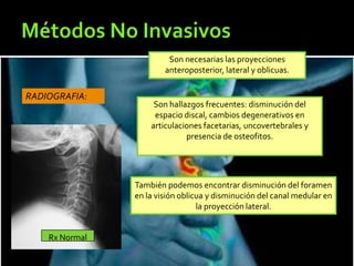 Hernias discales final | PPTX