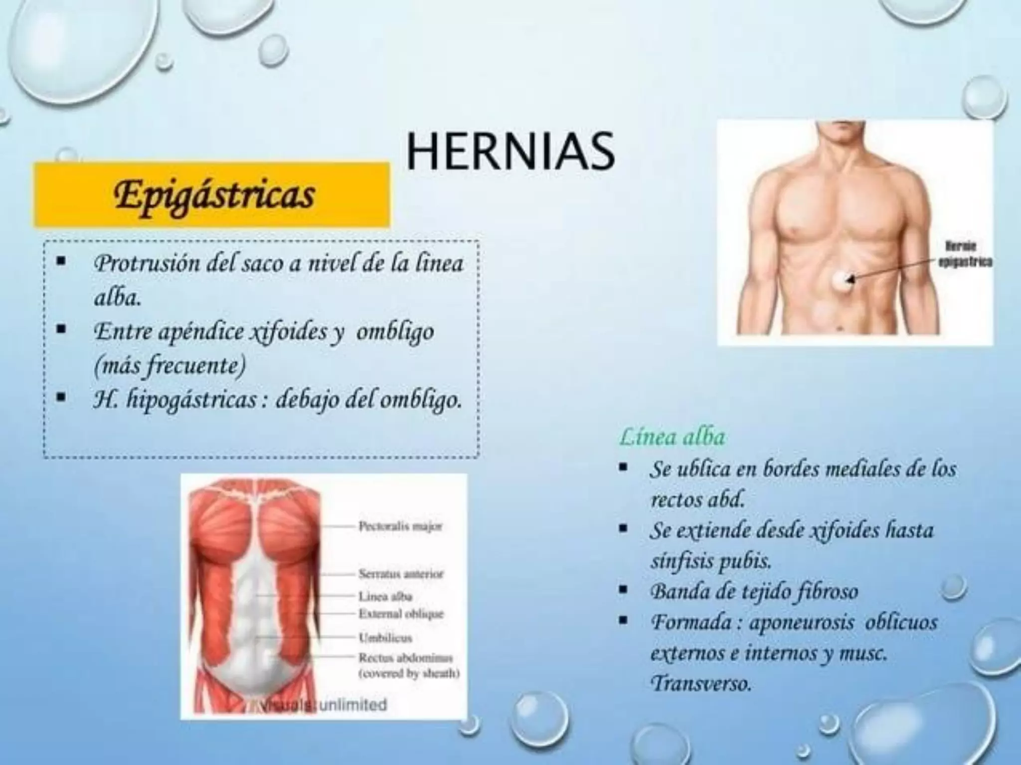 HERNIAS EXPO JAROLD JUSTO.pdf