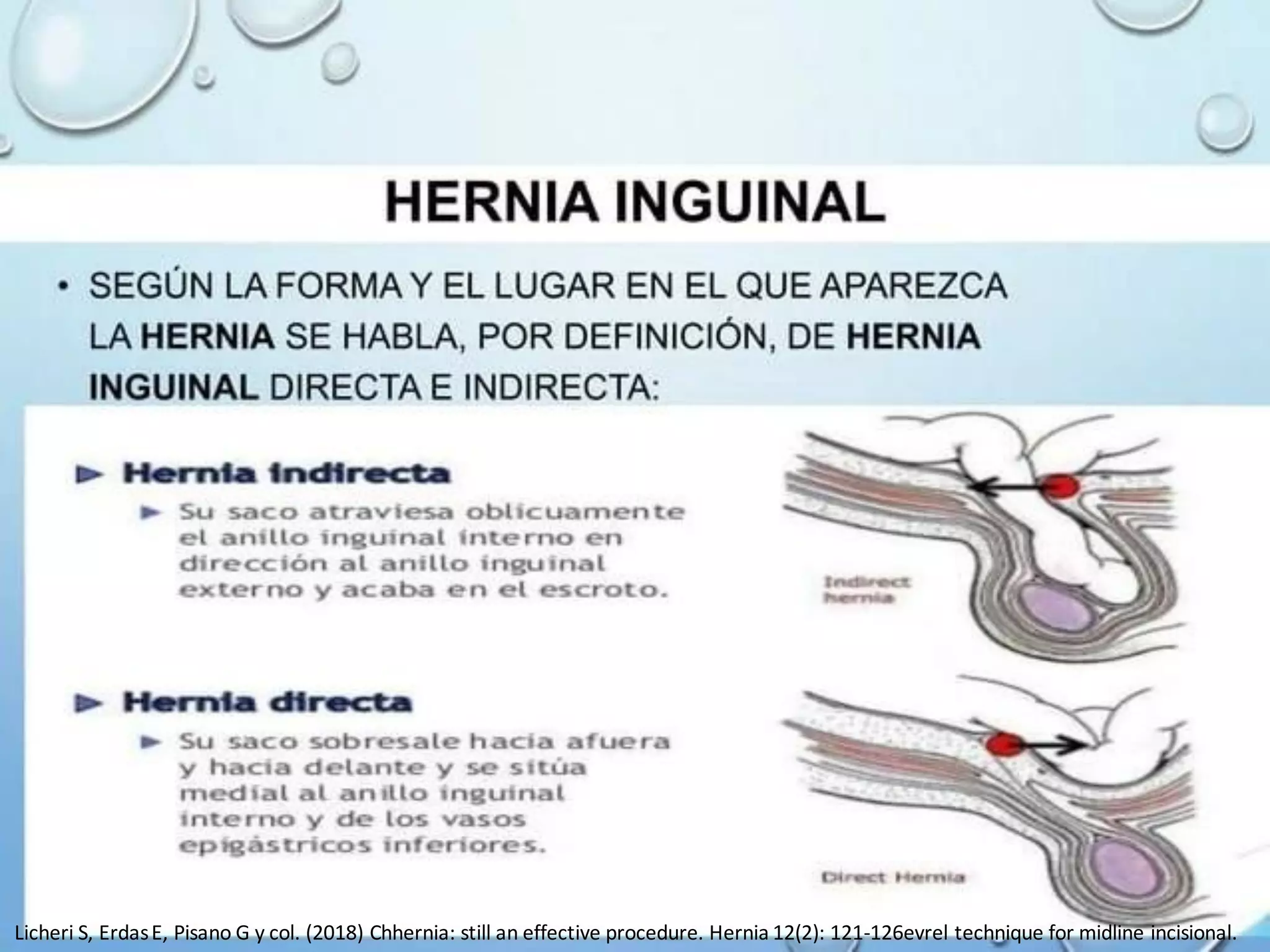 HERNIAS EXPO JAROLD JUSTO.pdf